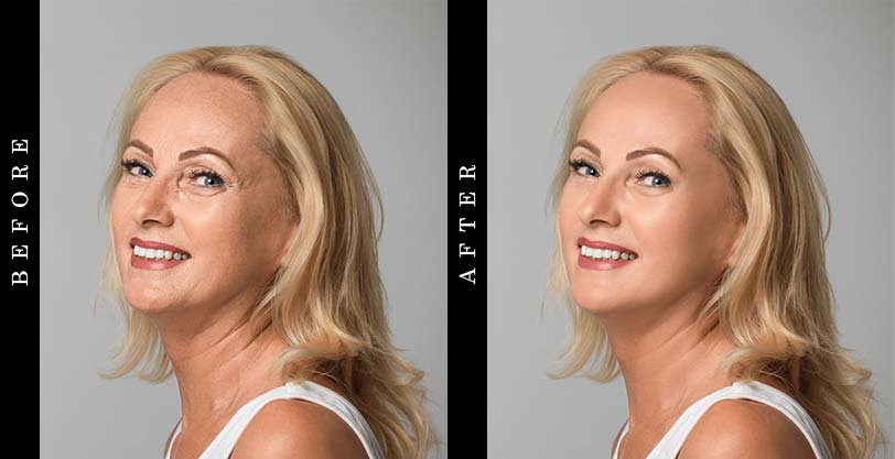 Serious Skincare Insta Tox Reviews 2023 | Reviewed By Dermatologists